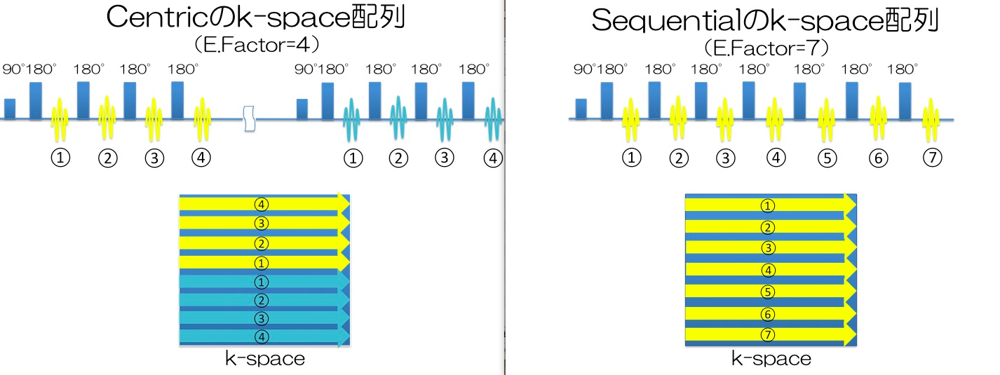 FSE（ファーストスピンエコー）についてー日立編 | MRIfan.net
