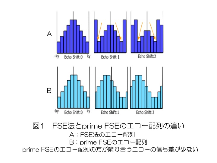 日立のprime FSEシークエンスについて | MRIfan.net