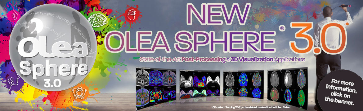 RSNA2015 ー 東芝からの追加情報 | MRIfan.net