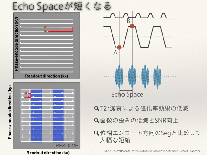 RESOLVEの技術について（SIEMENSユーザより） | MRIfan.net