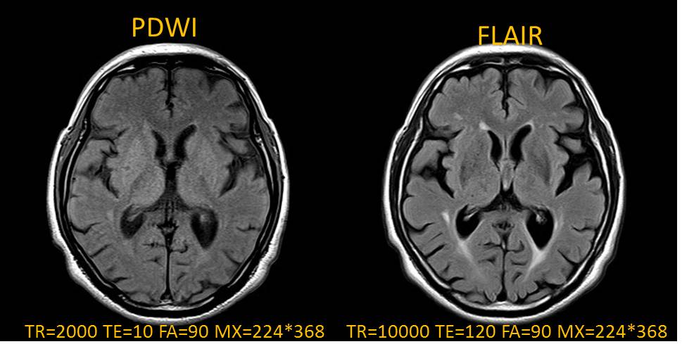 当院でもできる！DIR (like imaging) | MRIfan.net