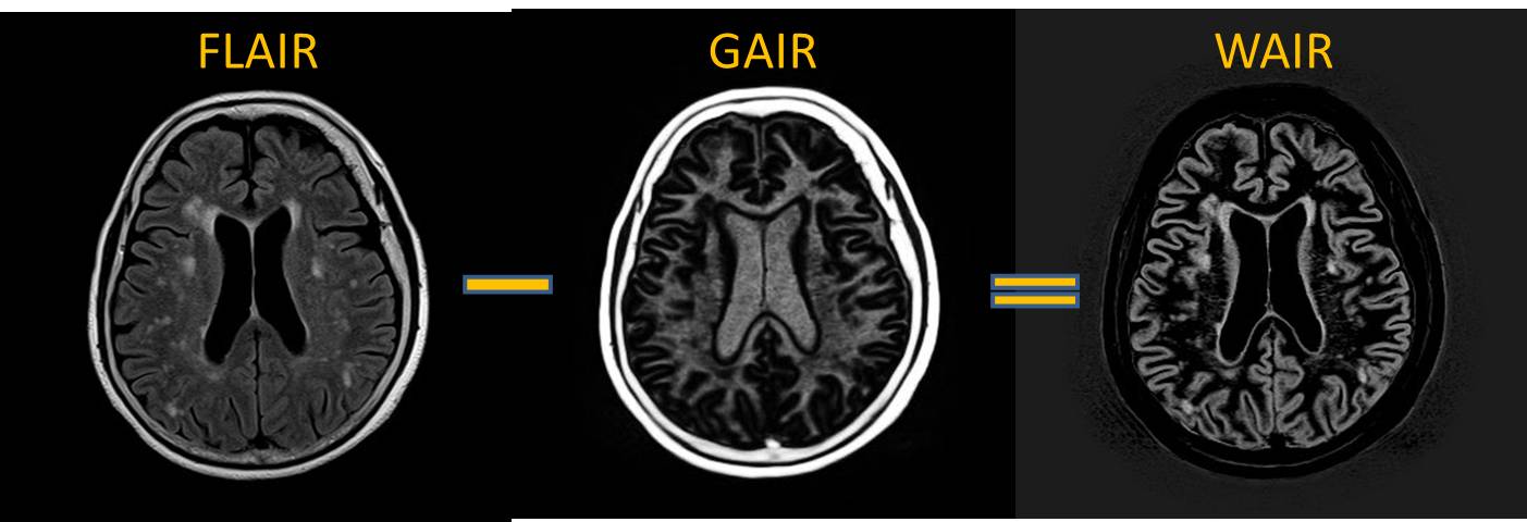 当院でもできる！DIR (like imaging) | MRIfan.net