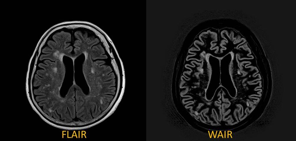 当院でもできる！DIR (like imaging) | MRIfan.net