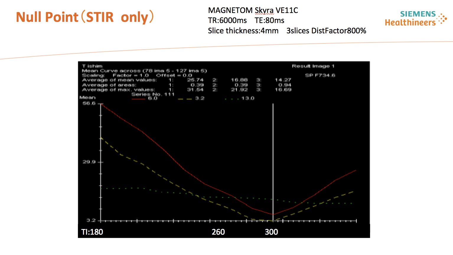 DWIにおけるSSGRとCHESS, STIRについて（補足説明） | MRIfan.net