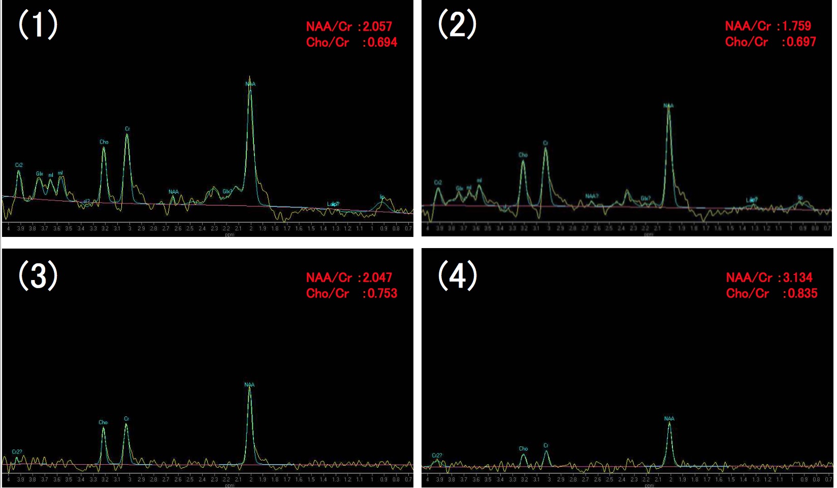 みなさん！！MRSだって面白いんだよ！！ | MRIfan.net