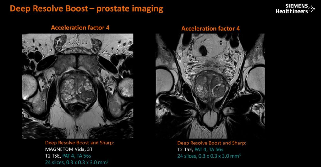 ITEM2022~Siemens編~ | MRIfan.net