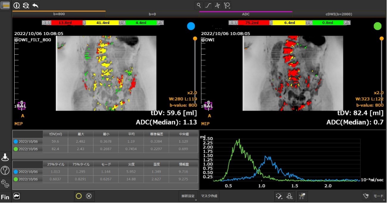 Composing(Stitching)時の輝度補正がADCカラーmapを変えてしまう | MRIfan.net