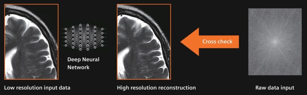 ITEM 2023 レポート SIEMENS編 | MRIfan.net