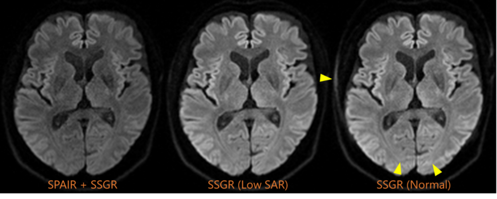 SSGR自由自在@SIEMENS | MRIfan.net