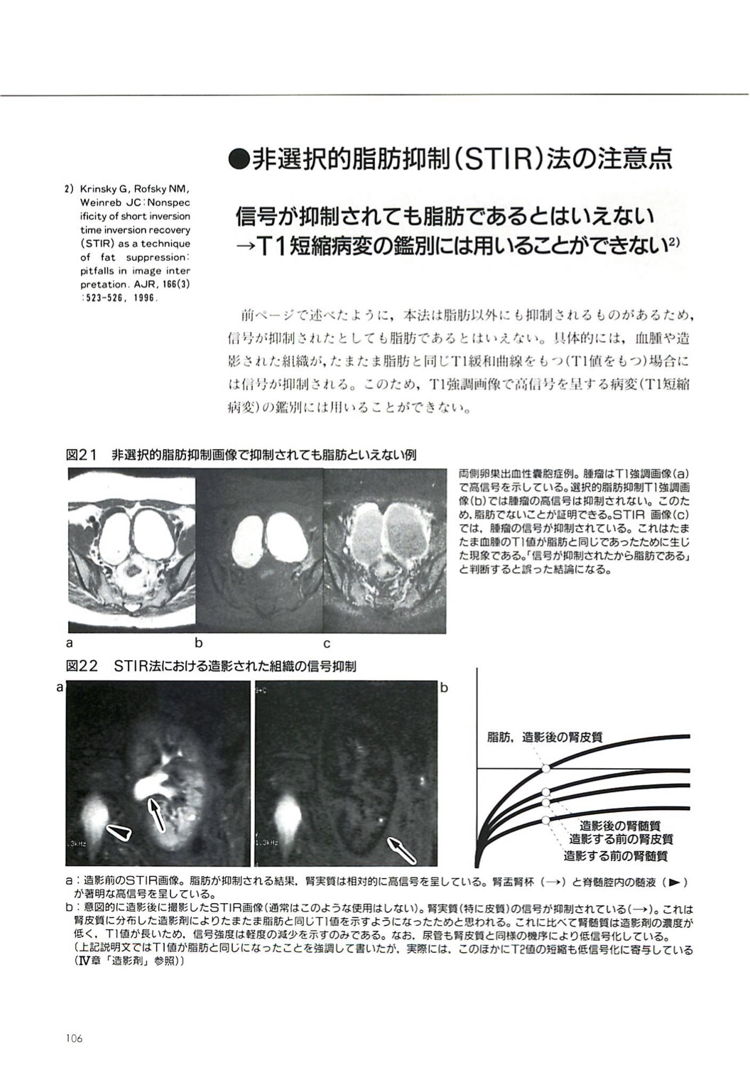 STIR法とはなにか（MR学会シンポジウムでの誤り、および発表時間遵守も含めて） | MRIfan.net