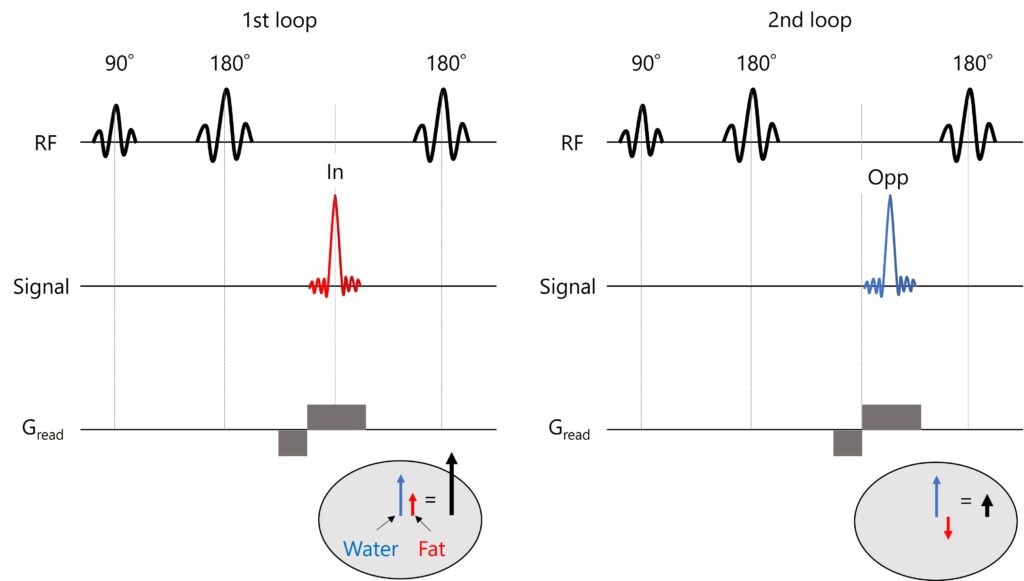 Fast Dixon法の特徴と注意点 | MRIfan.net