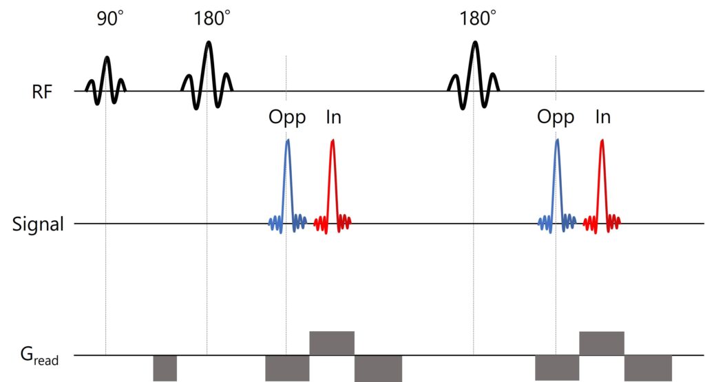 Fast Dixon法の特徴と注意点 | MRIfan.net