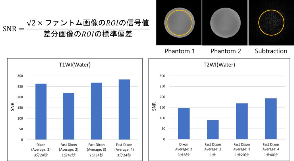 Fast Dixon法の特徴と注意点 | MRIfan.net