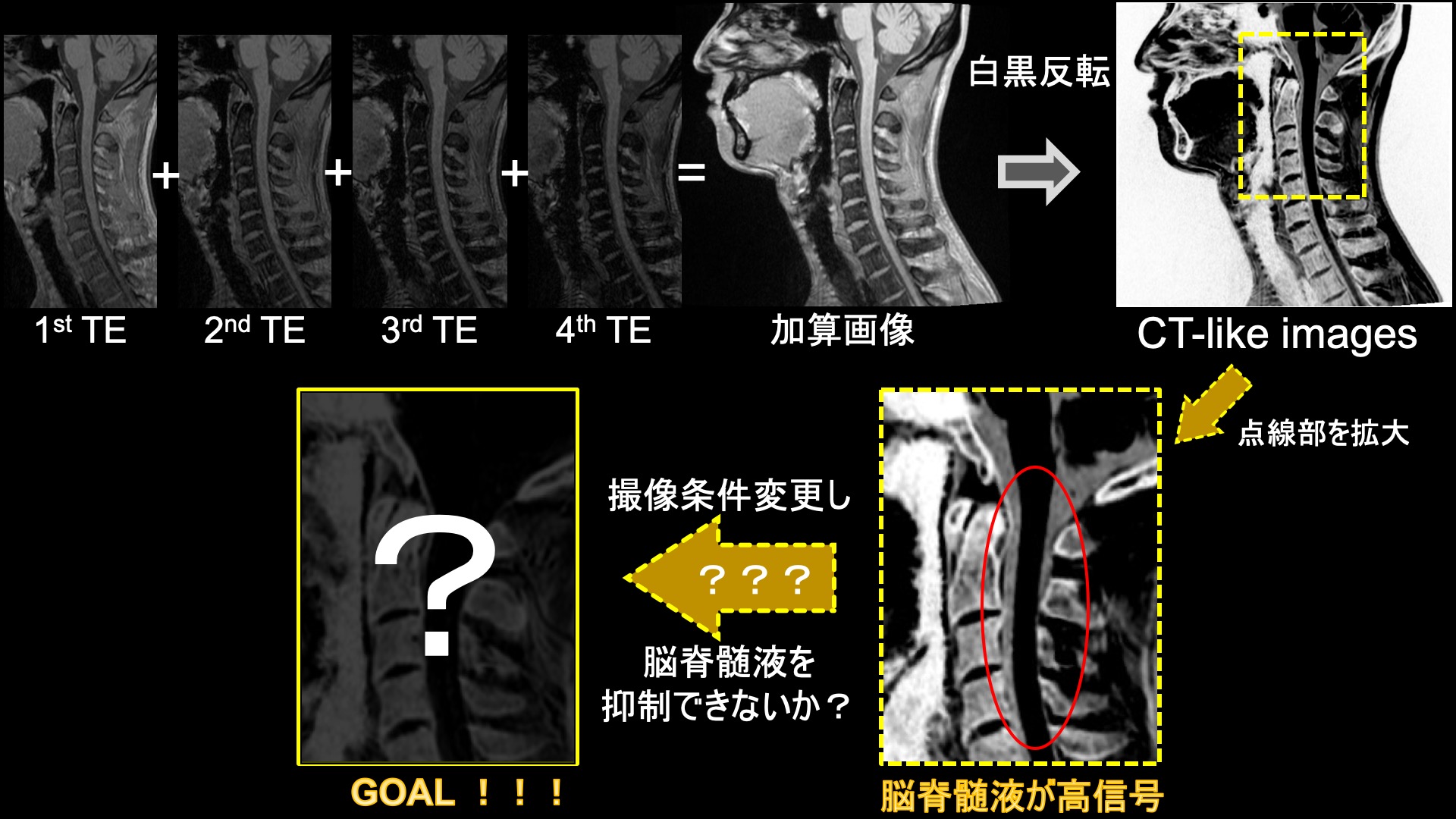 誰でも撮れる？『頚椎CTLI』 | MRIfan.net