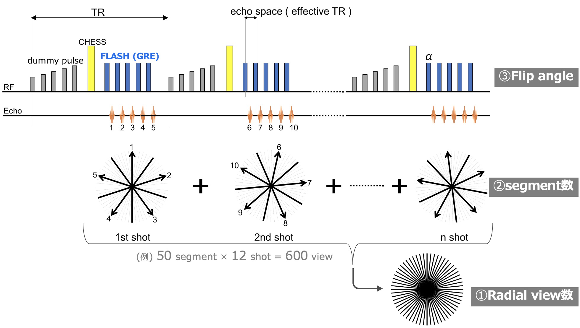 自由呼吸・非同期・非造影MRA『Radial GRE』 | MRIfan.net
