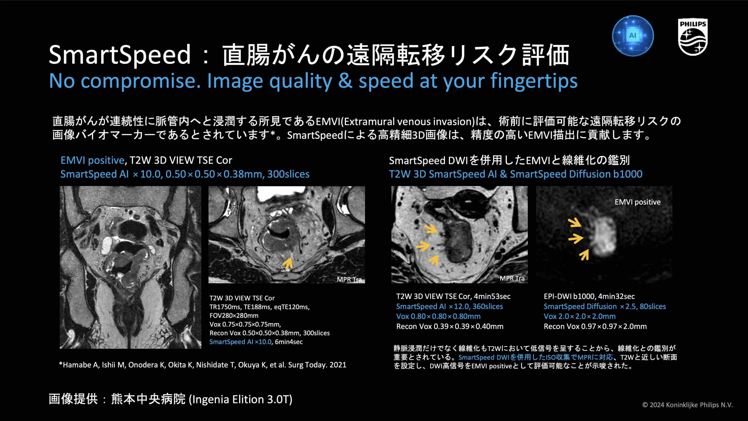 ITEM2024レポート〜Philips編〜 | MRIfan.net