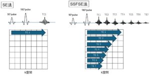 SSFSEのブラーリングについて | MRIfan.net