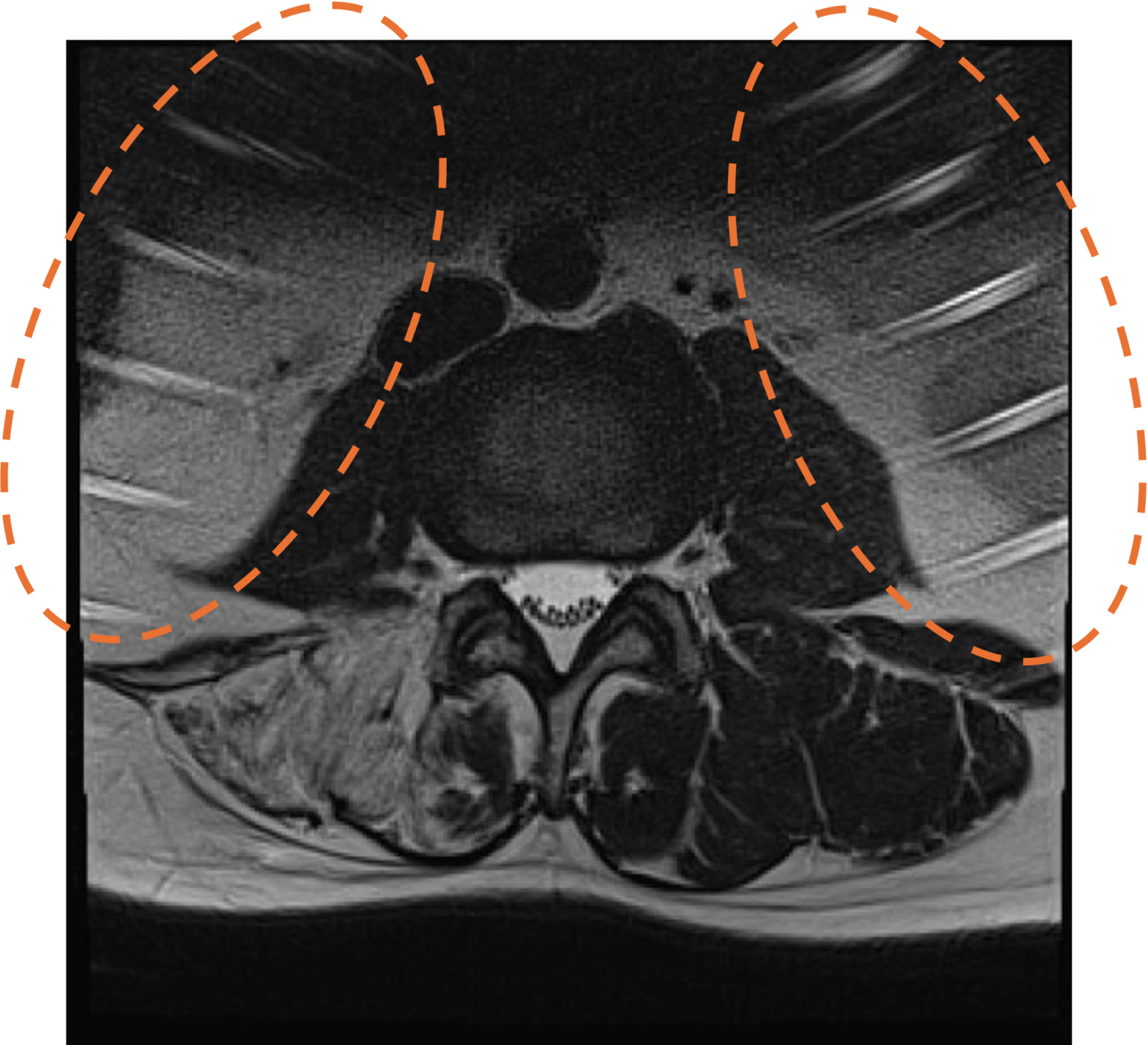 Radial scanについて少しだけ理解を深める | MRIfan.net