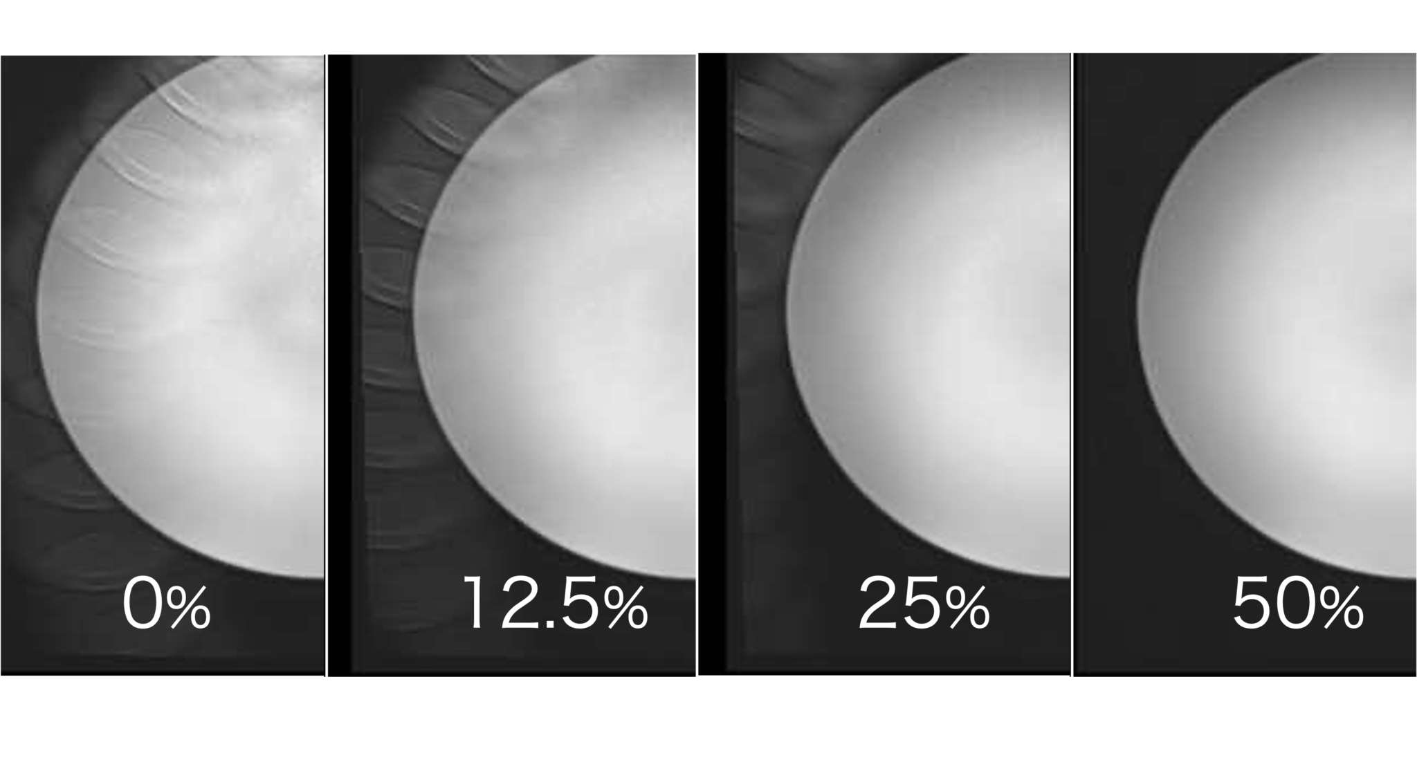 ★Radial scanについて少しだけ理解を深める | MRIfan.net