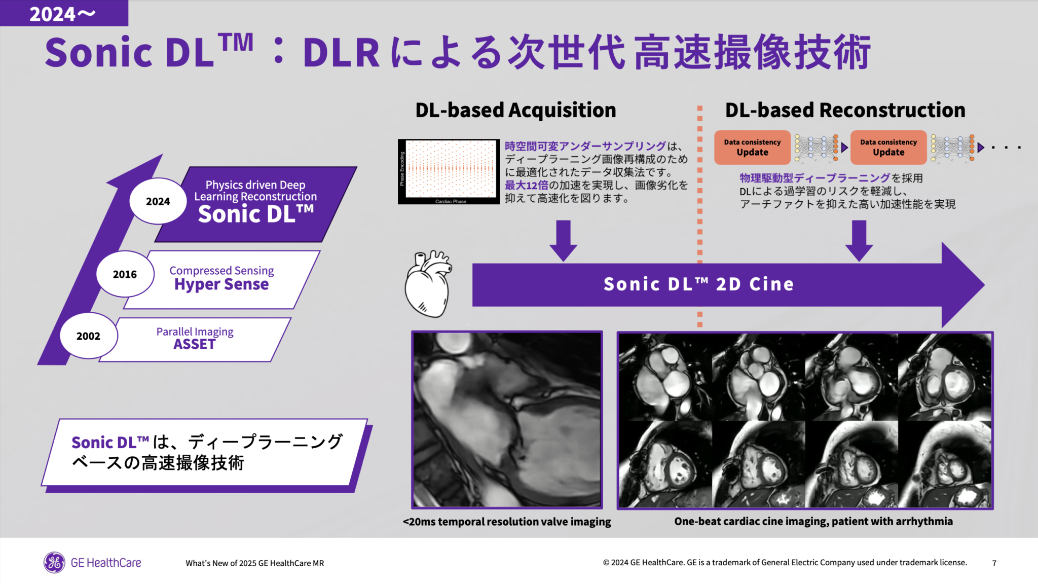 ITEM2025レポート 〜GEヘルスケア編〜 | MRIfan.net