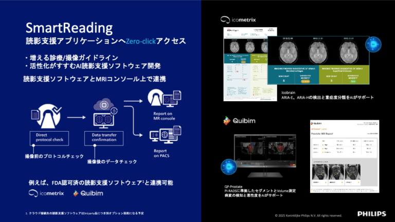 ITEM2025レポート〜Philips編〜 | MRIfan.net