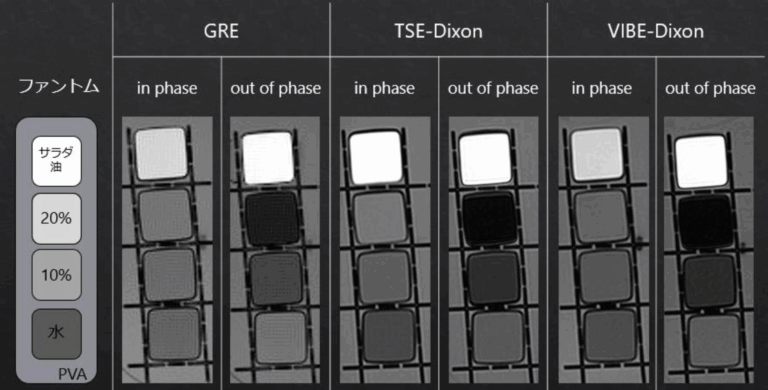 GRE と各種Dixon によるin phase、out of phase での信号変化について | MRIfan.net